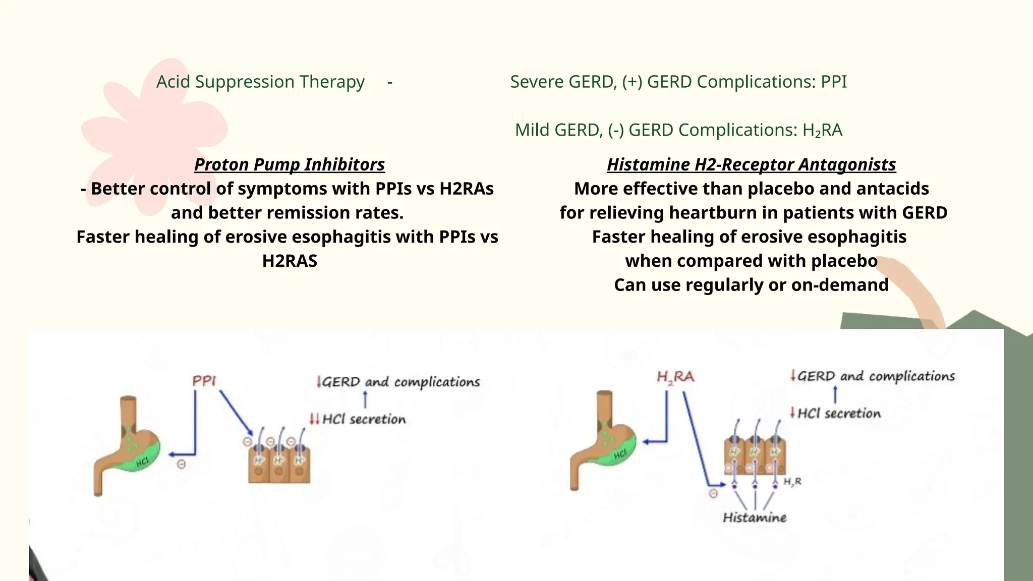 GERD (Gastroesophageal reflux disease) tejas.pptx. | PPTX
