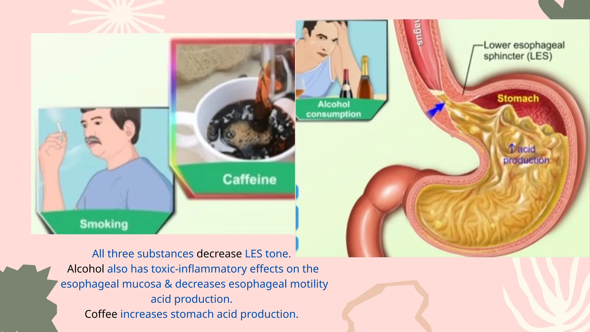 GERD (Gastroesophageal reflux disease) tejas.pptx. | PPTX