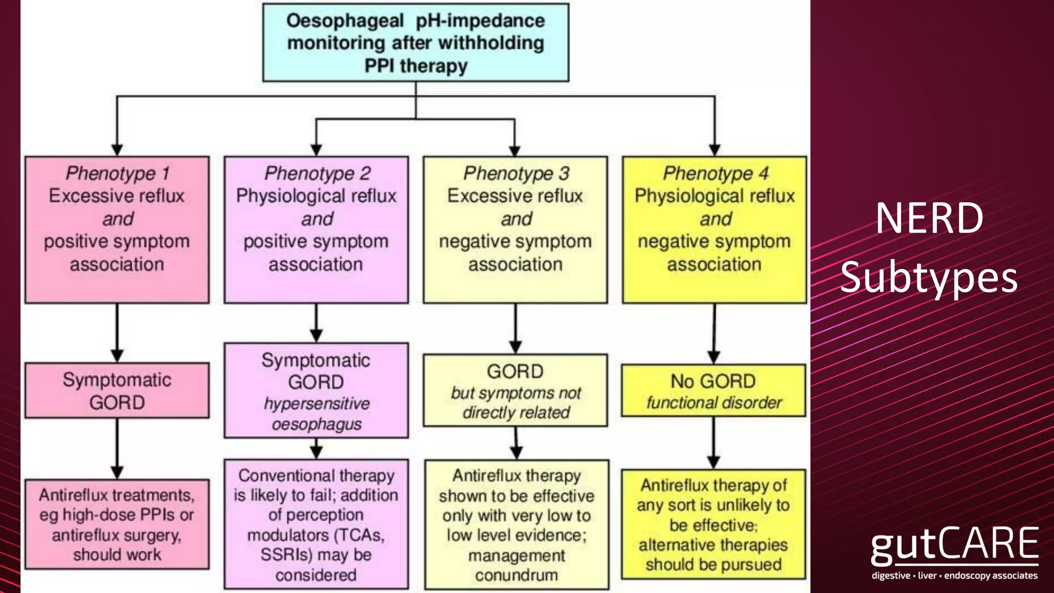 GERD: Current Paradigms | PDF