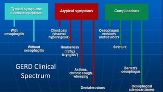 GERD: Current Paradigms | PDF