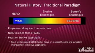 GERD: Current Paradigms | PDF