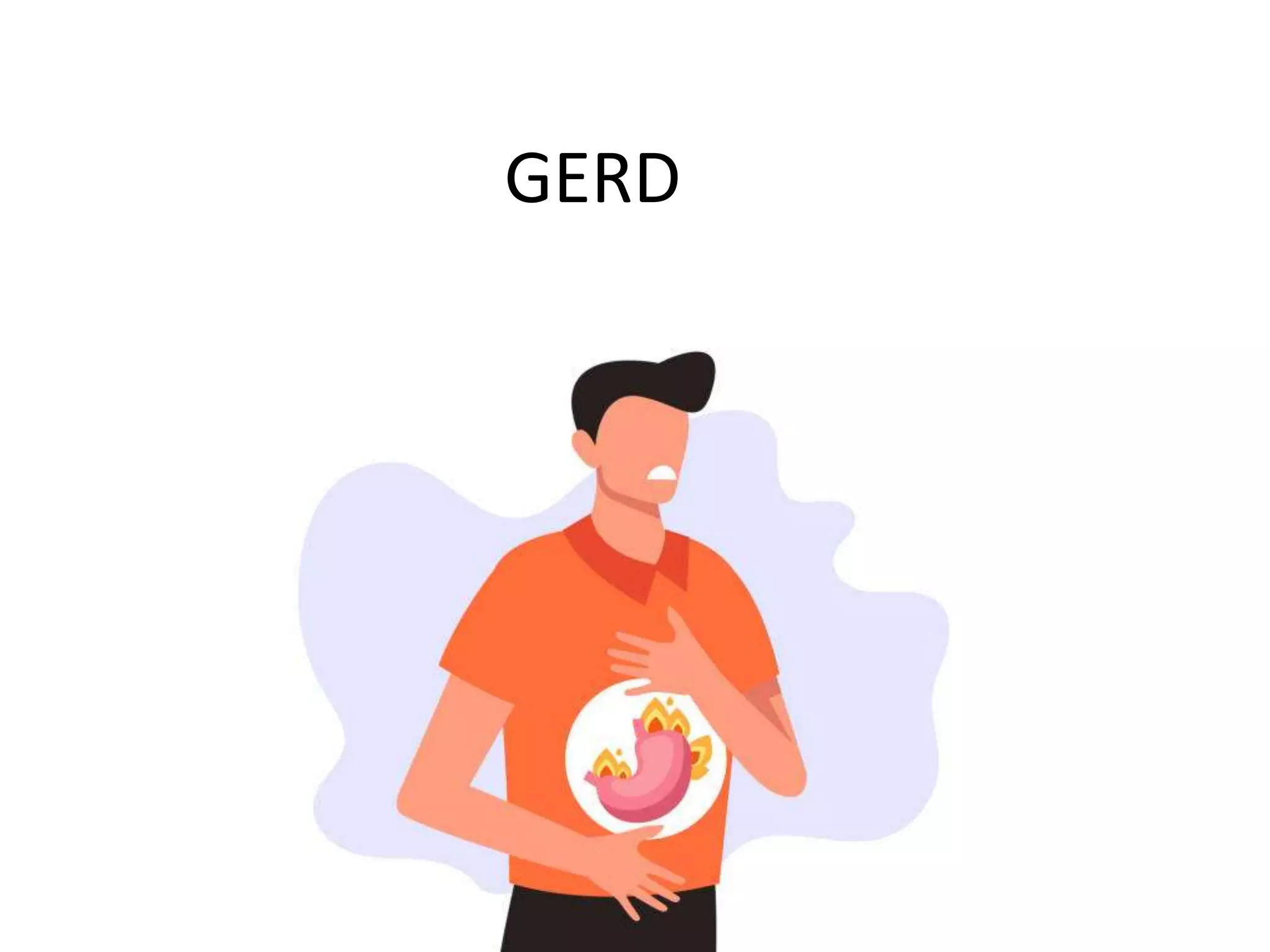 GERD / GASTRO ESOPHAGEAL REFLUX | PPTX