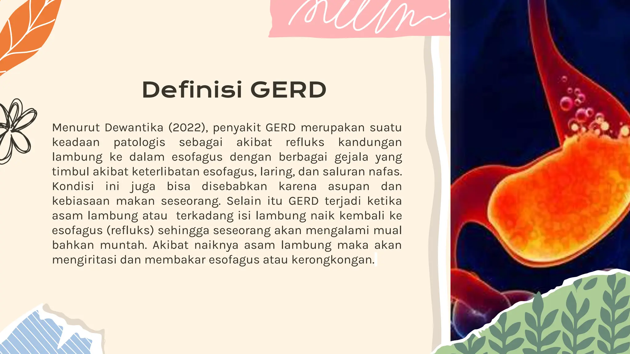 asuhan keperawatan kritis pada kasus gerd | PPTX