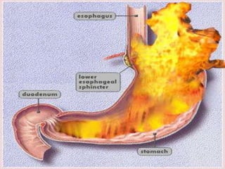 gerddrsendhil-stomach system gut splinter.pdf