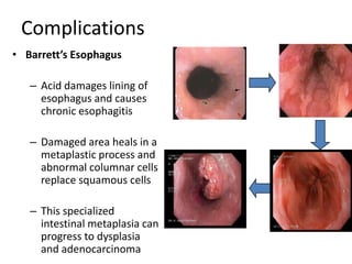 gerddrsendhil-stomach system gut splinter.pdf