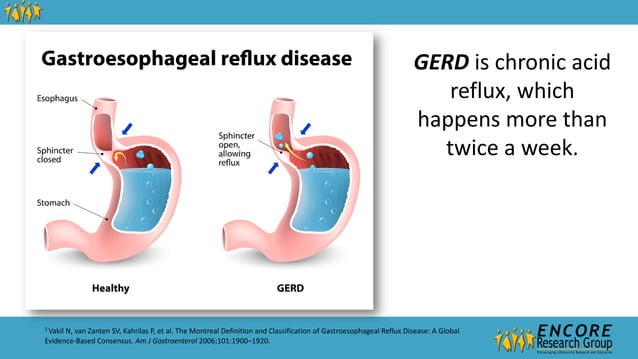 GERD encore ppt.pdf | Digestive Disorders | Diseases and Conditions