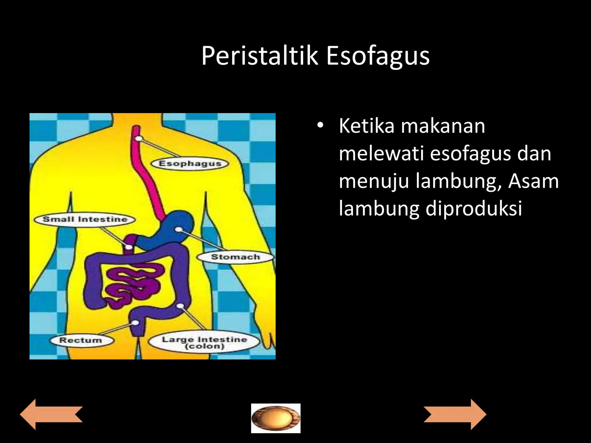 Gastro Esophageal Reflux Disease Kuliah smester IV.ppt