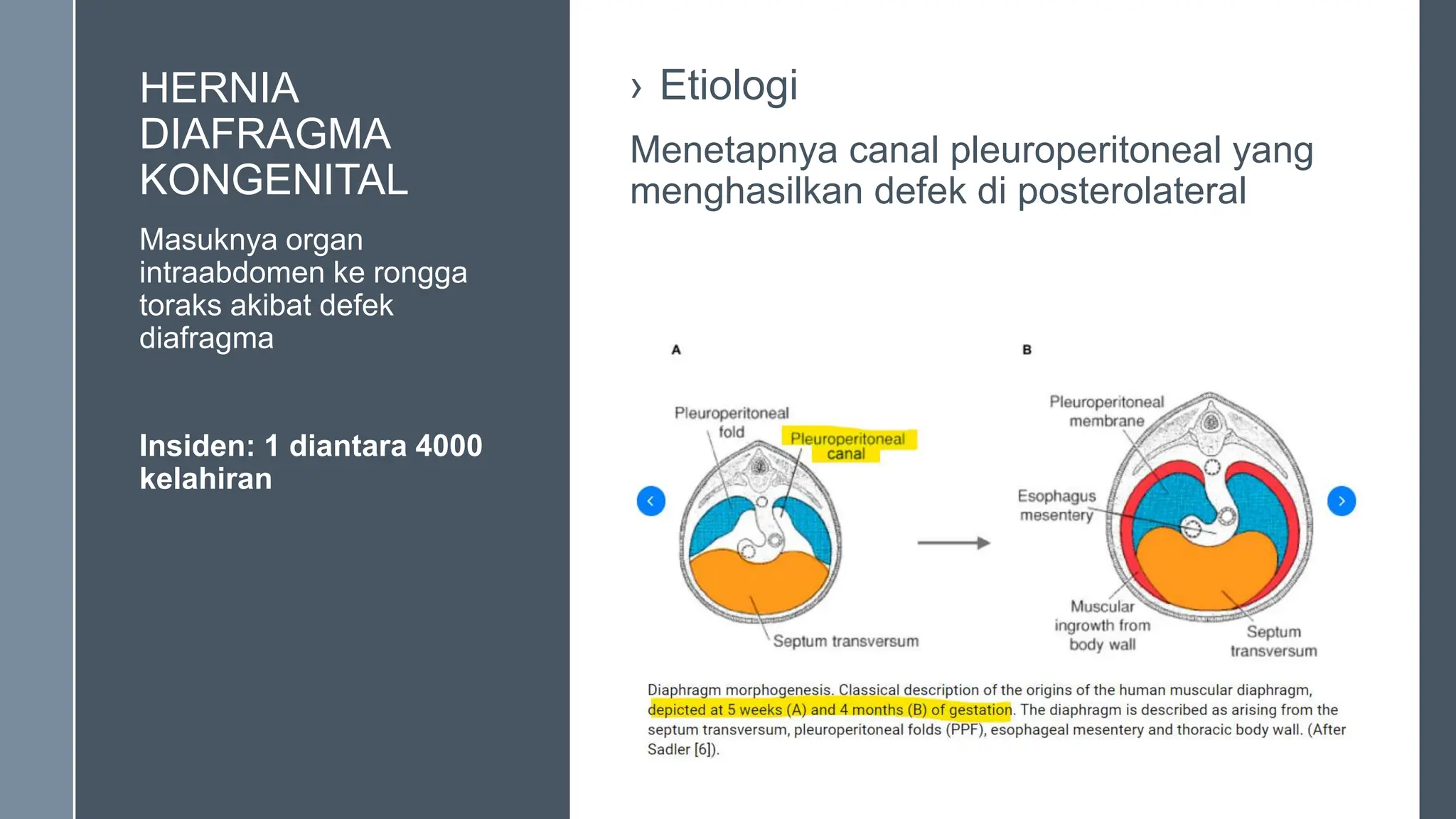 GERD, Perdarahan GI, Esophageal Atresia, Hernia Diafragma Kongenital ...