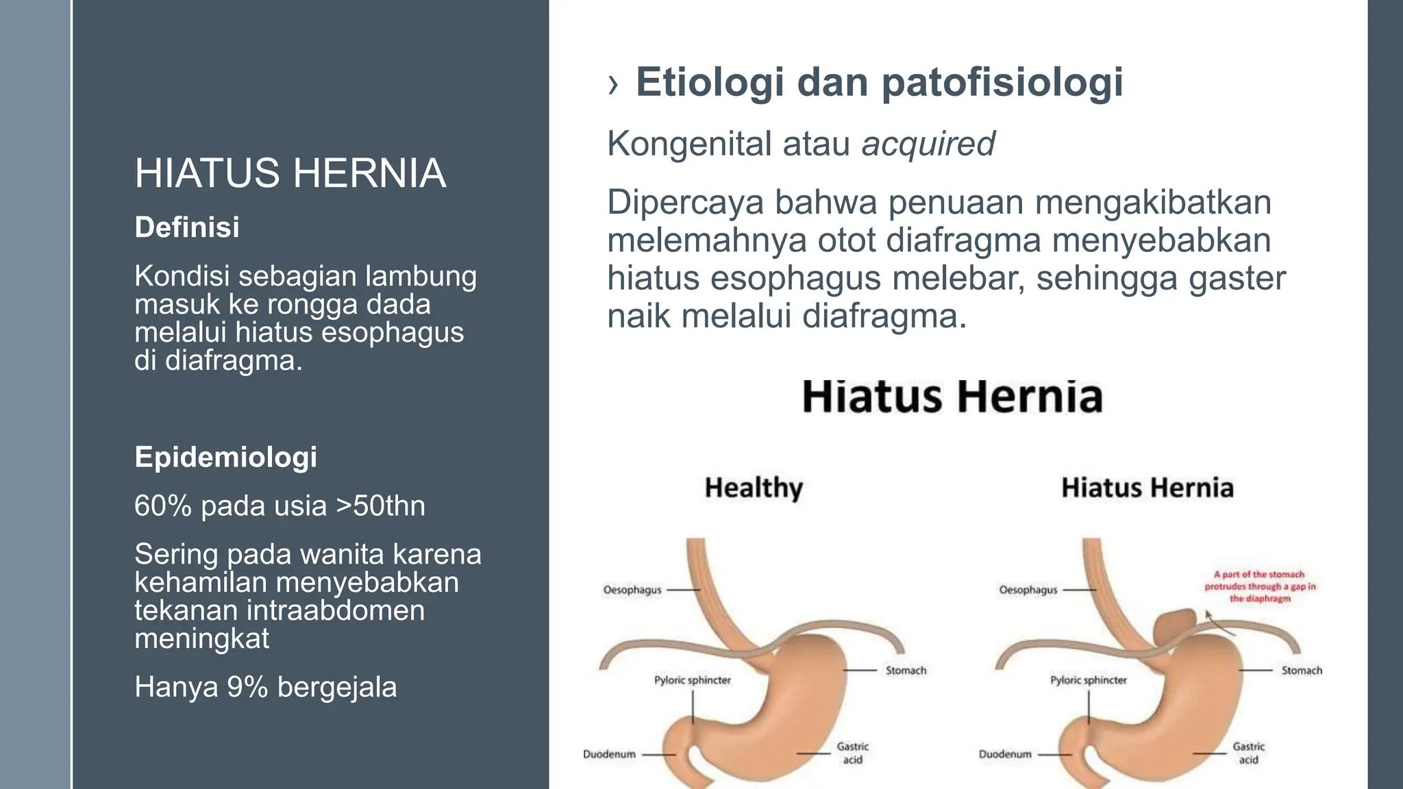 GERD, Perdarahan GI, Esophageal Atresia, Hernia Diafragma Kongenital ...