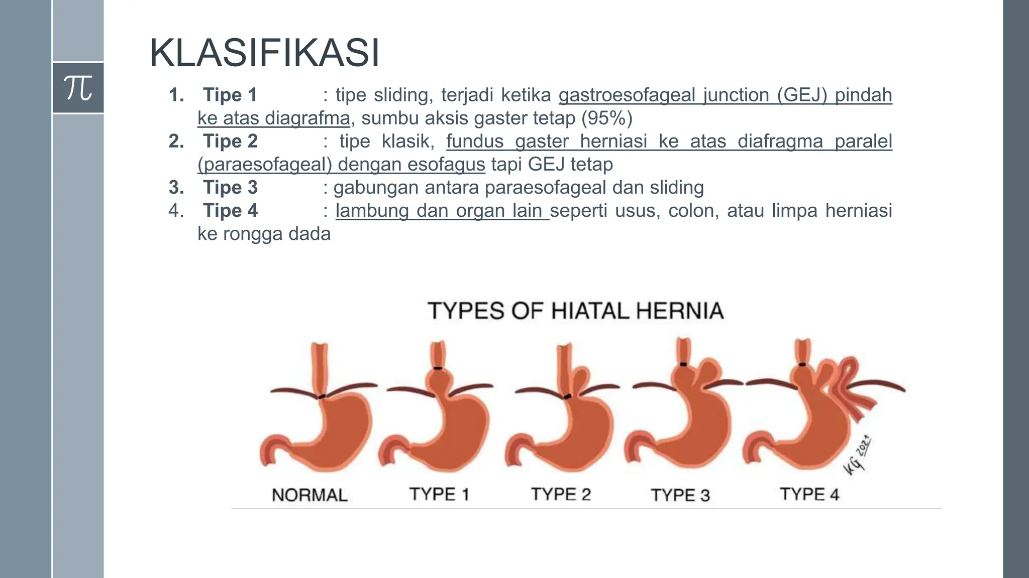 GERD, Perdarahan GI, Esophageal Atresia, Hernia Diafragma Kongenital ...