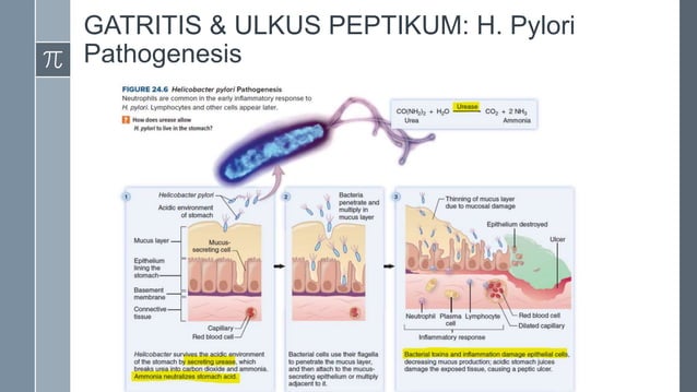 GERD, Perdarahan GI, Esophageal Atresia, Hernia Diafragma Kongenital ...