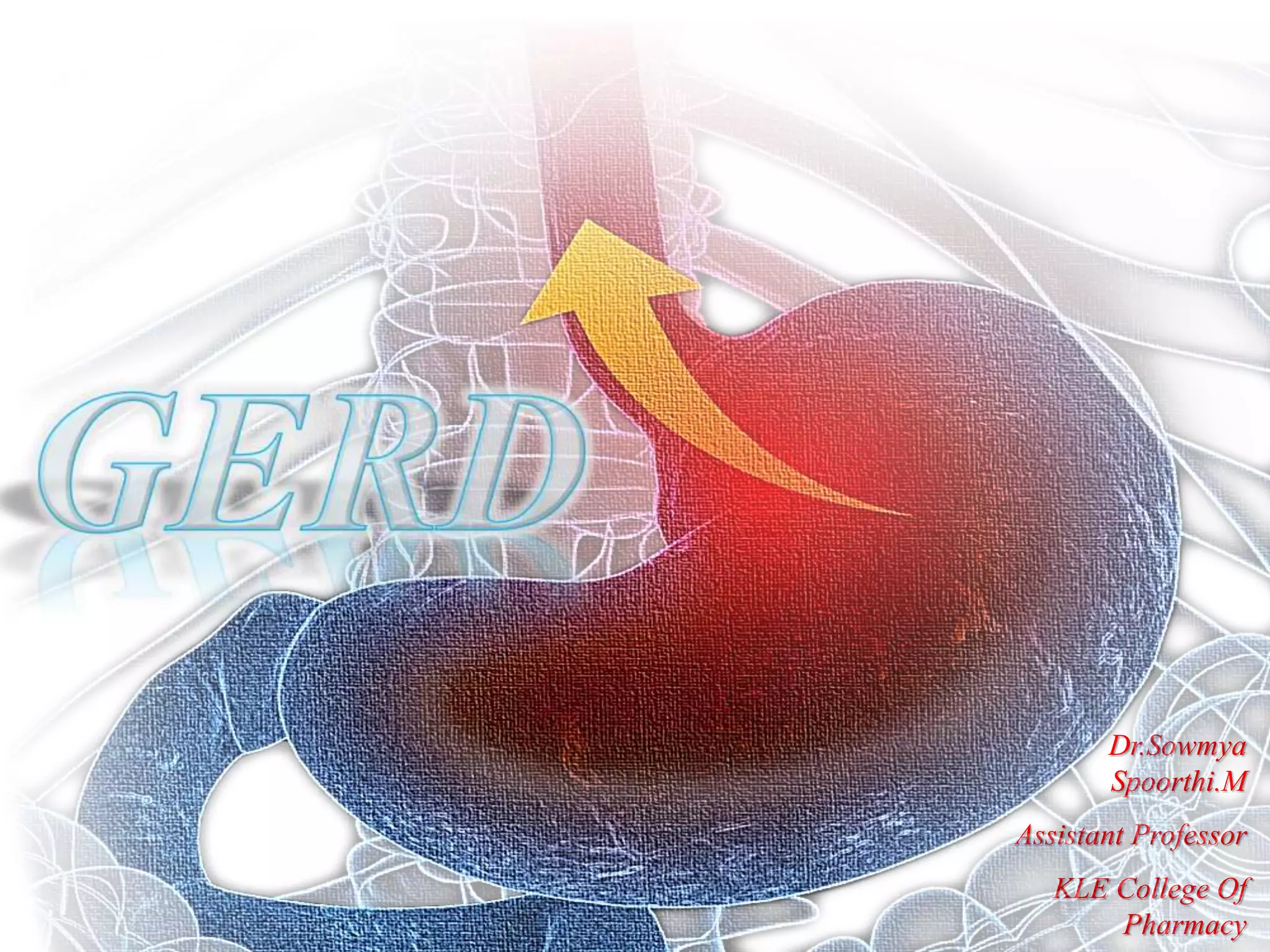 Gastro Esophageal Refulx Disease (GERD)presentation | PPTX