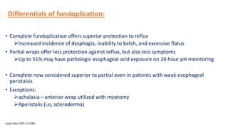 Gerd surgical management | PPTX