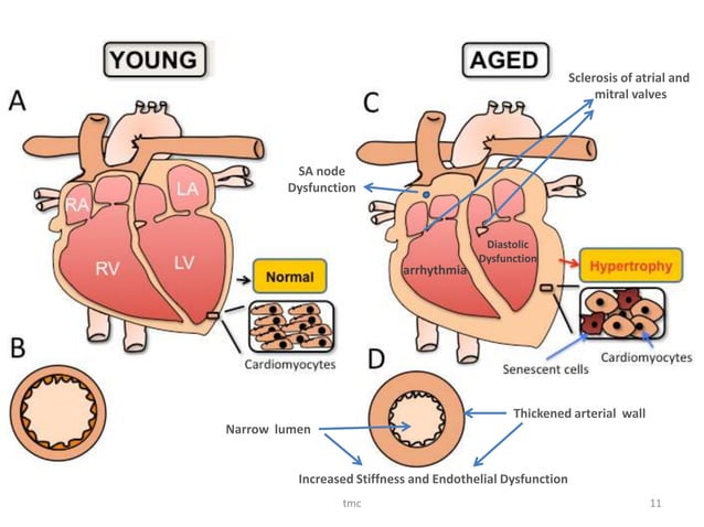 Geriatric anesthesia physiological changes and preoperative preparation ...