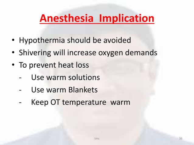 Anesthetic management of Geriatric patients | PPTX