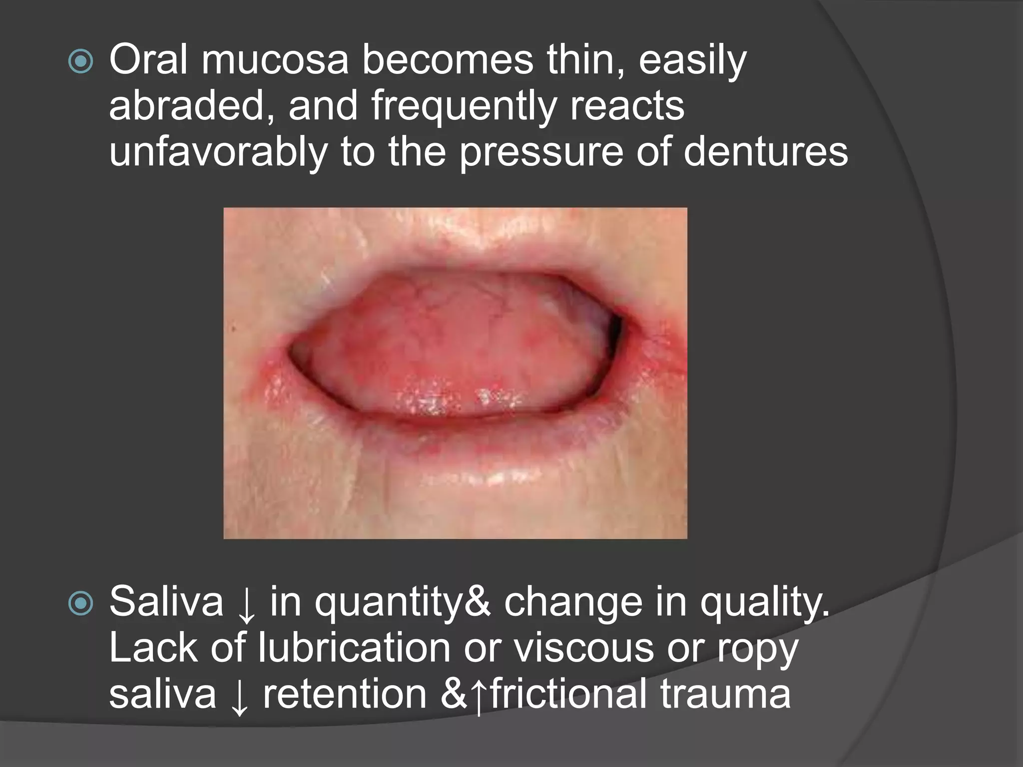 Geriatric dentistry | PPTX