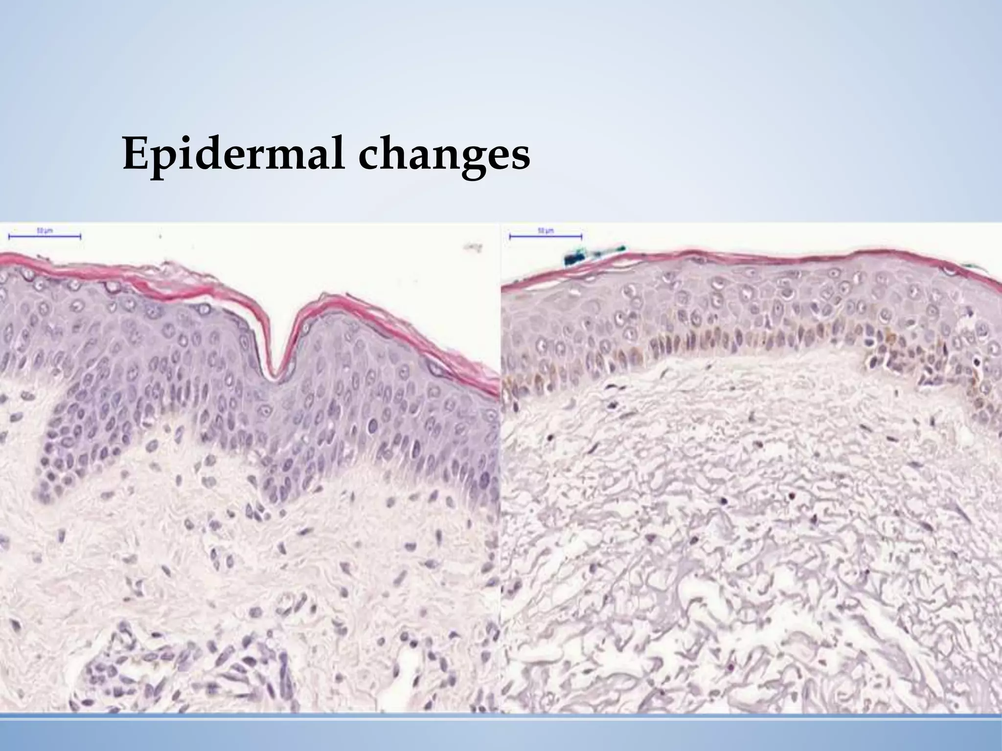 Ageing and Geriatric dermatoses | PPTX