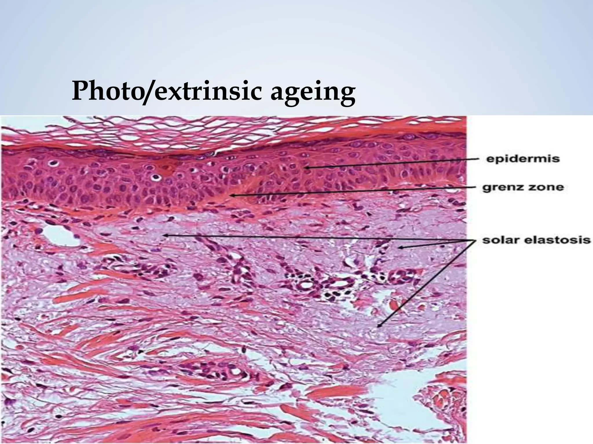Ageing and Geriatric dermatoses | PPTX