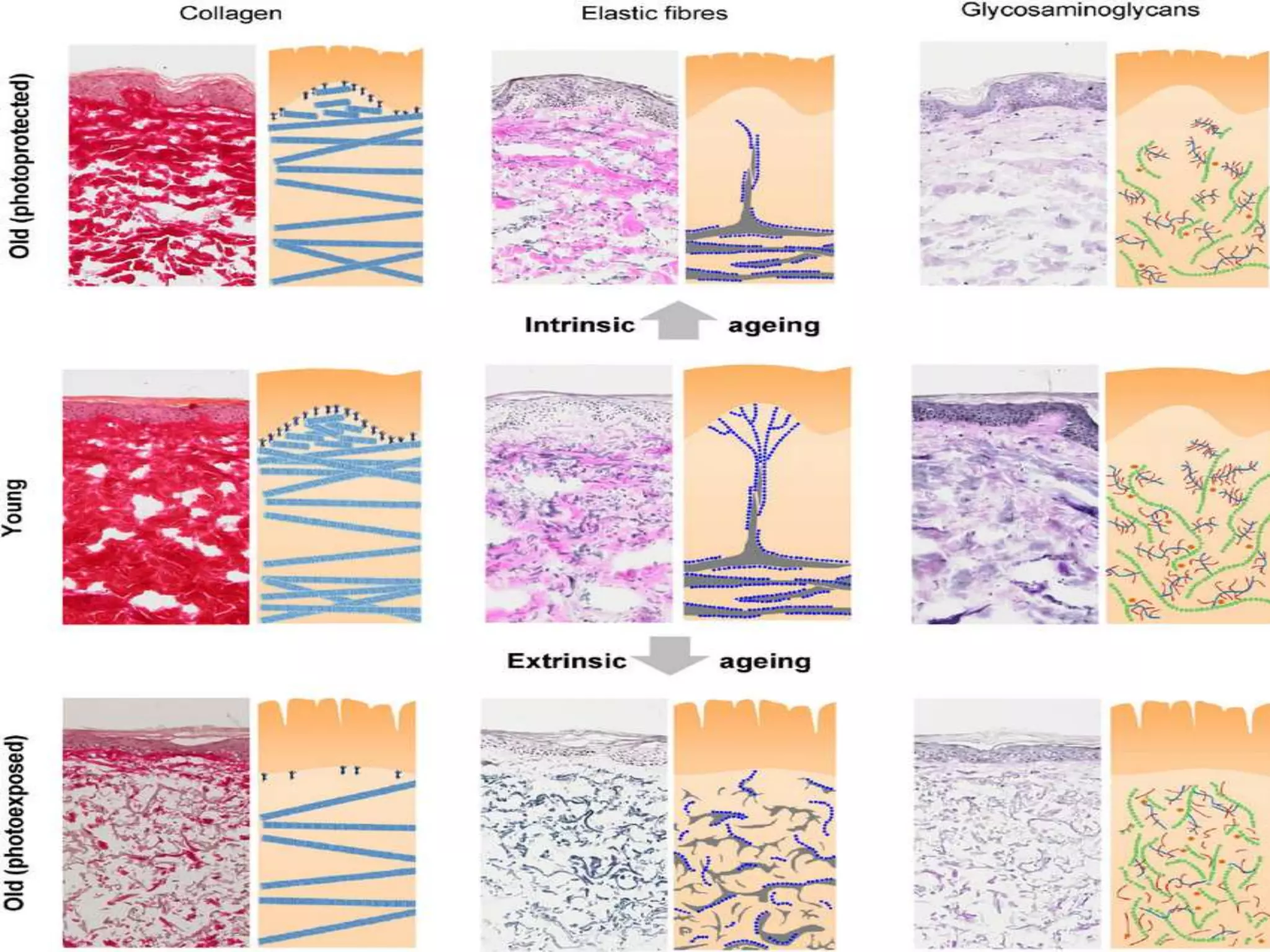 Ageing and Geriatric dermatoses | PPTX