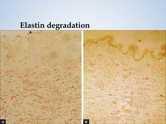 Ageing and Geriatric dermatoses | PPTX