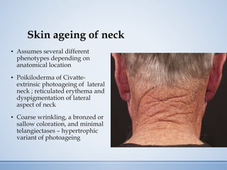 Ageing and Geriatric dermatoses | PPTX