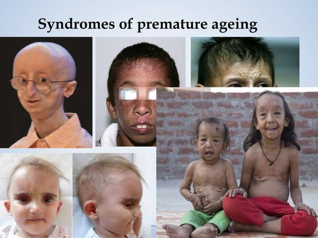 Ageing and Geriatric dermatoses | PPTX