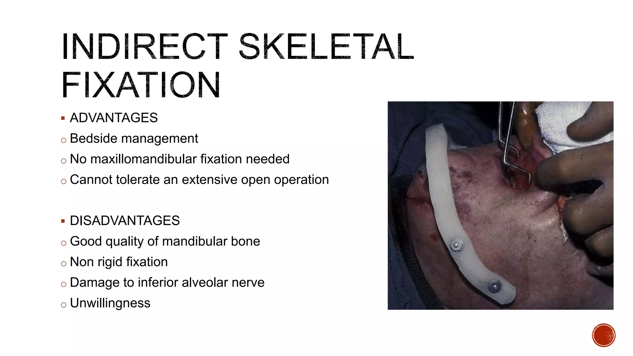 Geriatric fracture | PPTX