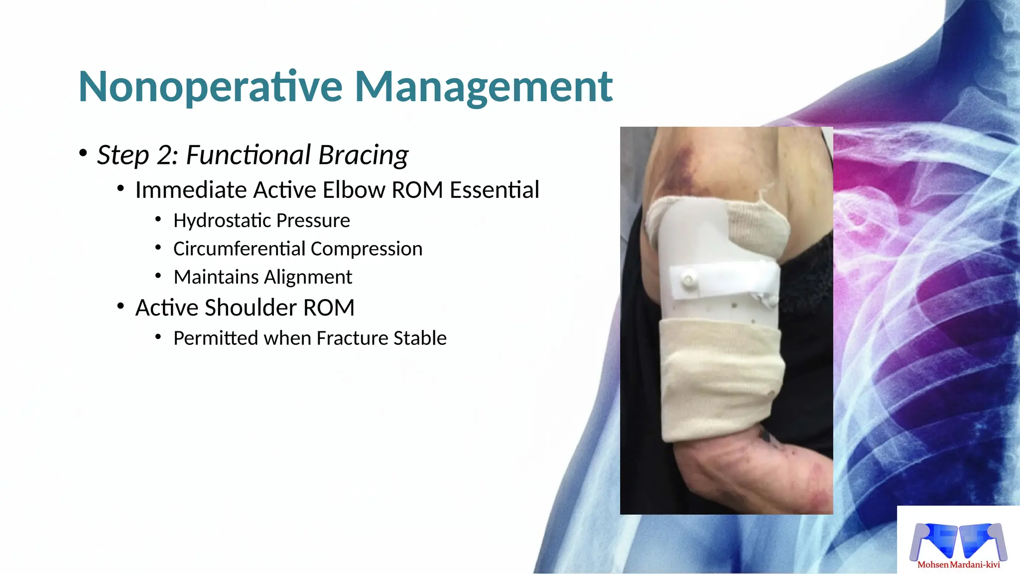 Geriatric Fractures Around the Shoulder & Elbow - Copy.pptx