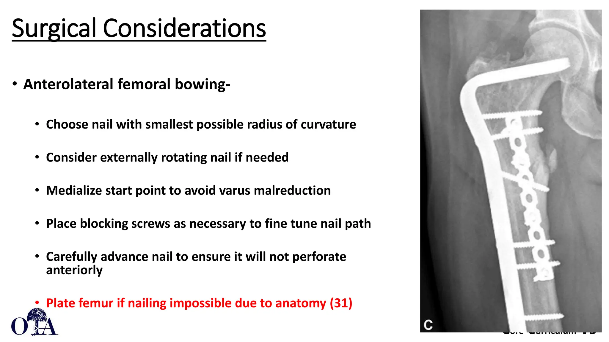 Geriatric Fx 2 Atypical Femur Fractures.pdf