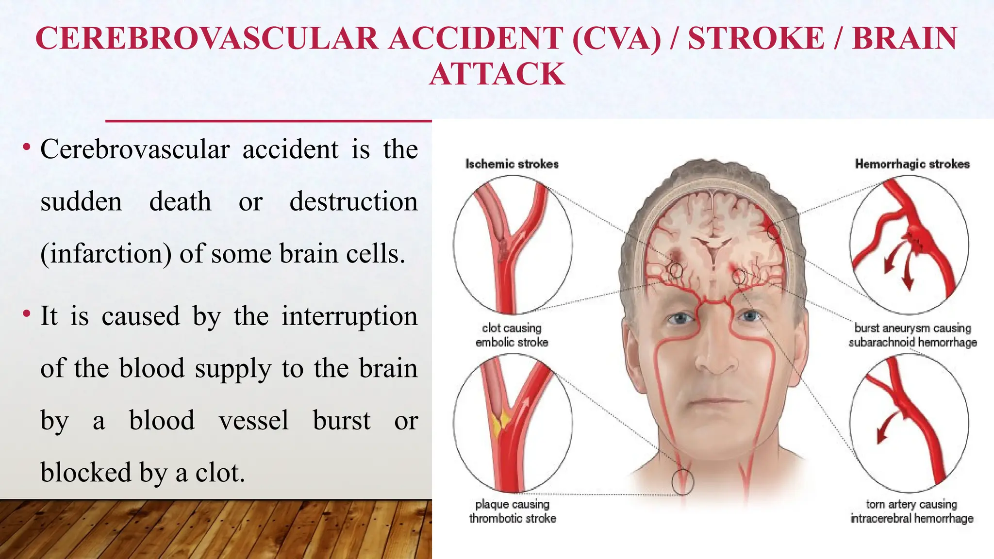 GERIATRIC NURSING.pptx Neurological Disorder of Elderly People | PPTX
