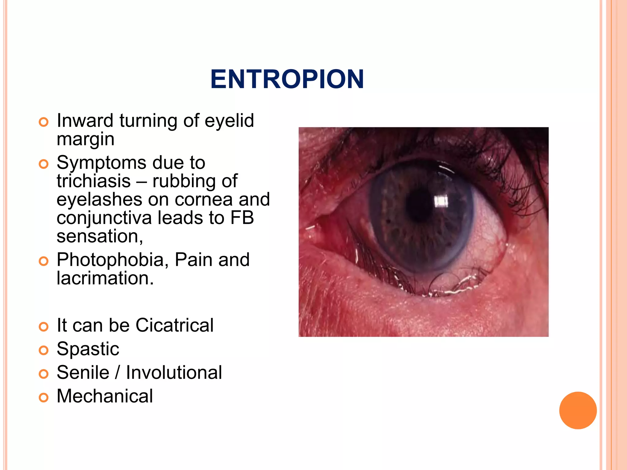 Geriatric ophthalmology | PPTX