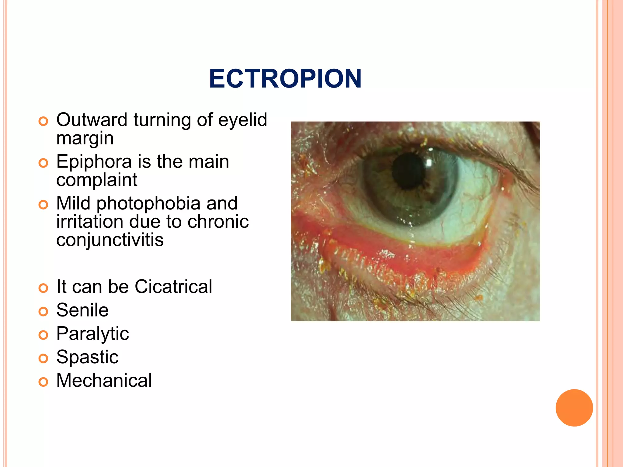 Geriatric ophthalmology | PPTX