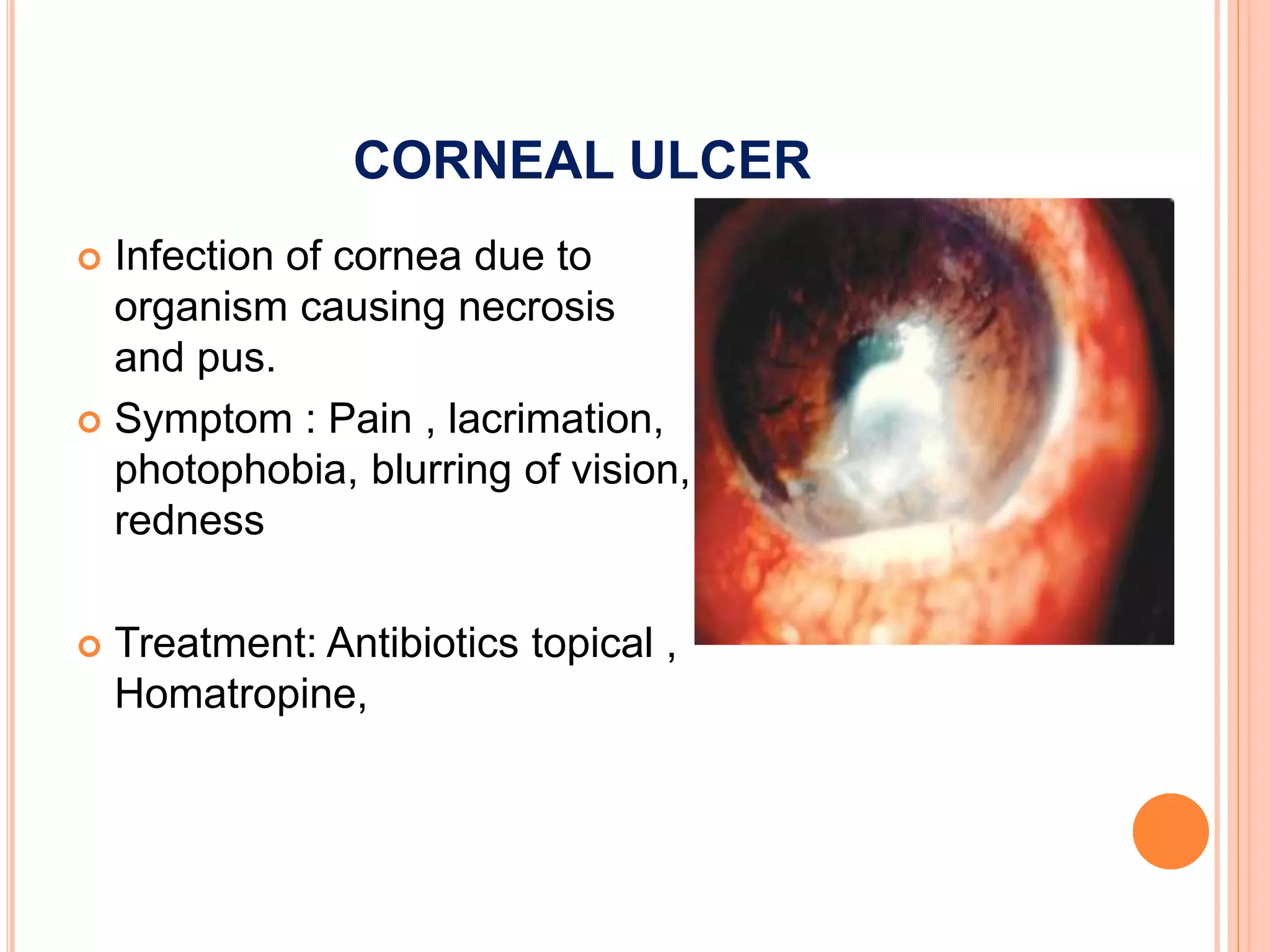 Geriatric ophthalmology | PPTX