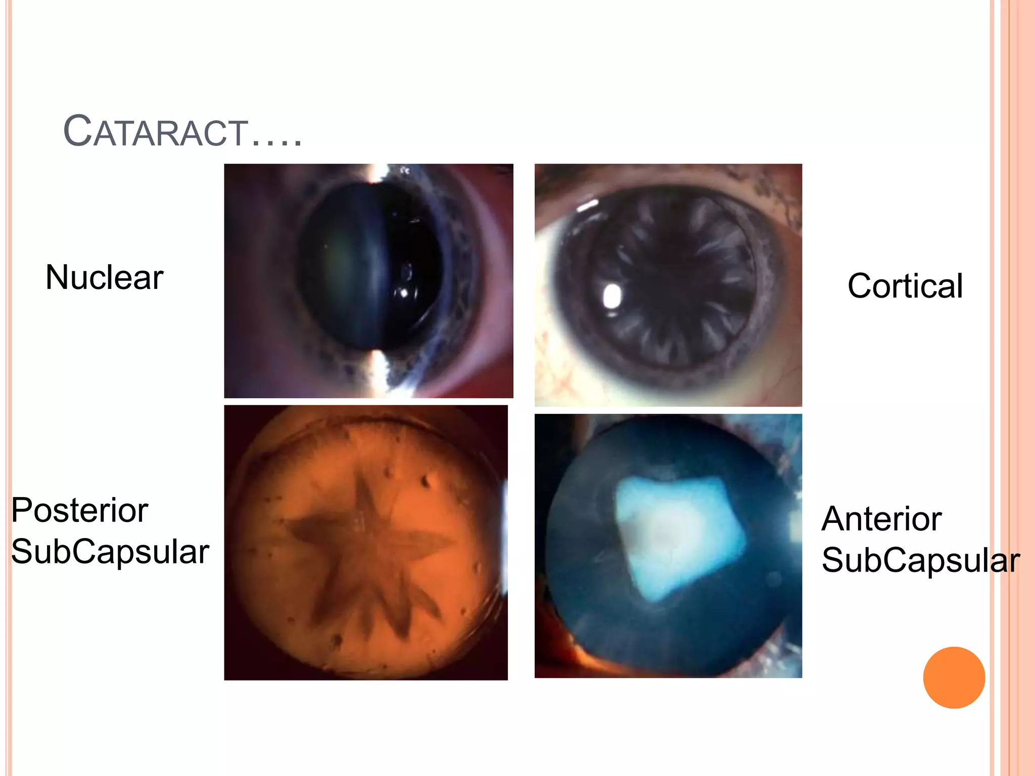Geriatric ophthalmology | PPTX