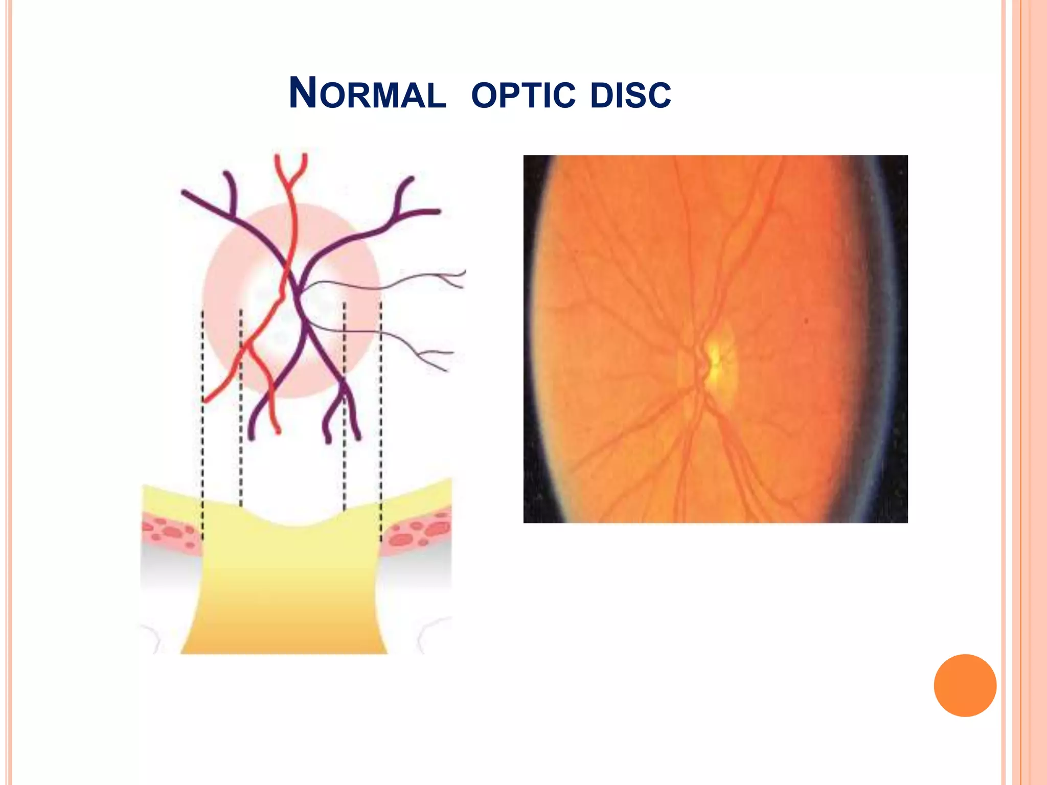 Geriatric ophthalmology | PPTX