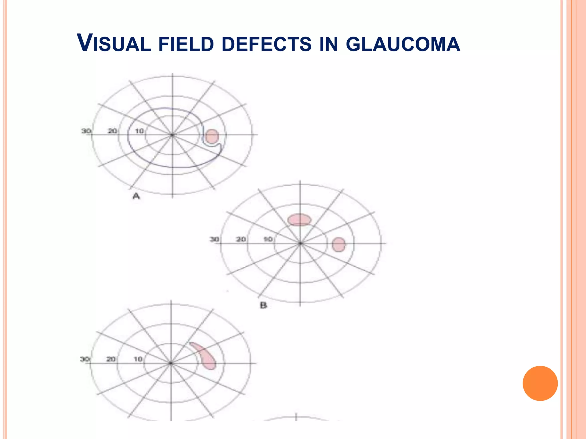 Geriatric ophthalmology | PPTX