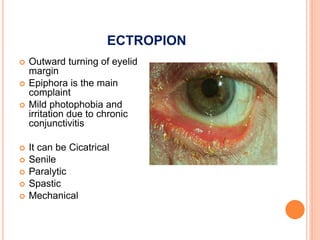 Geriatric ophthalmology | PPTX