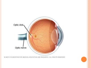 Geriatric ophthalmology | PPTX