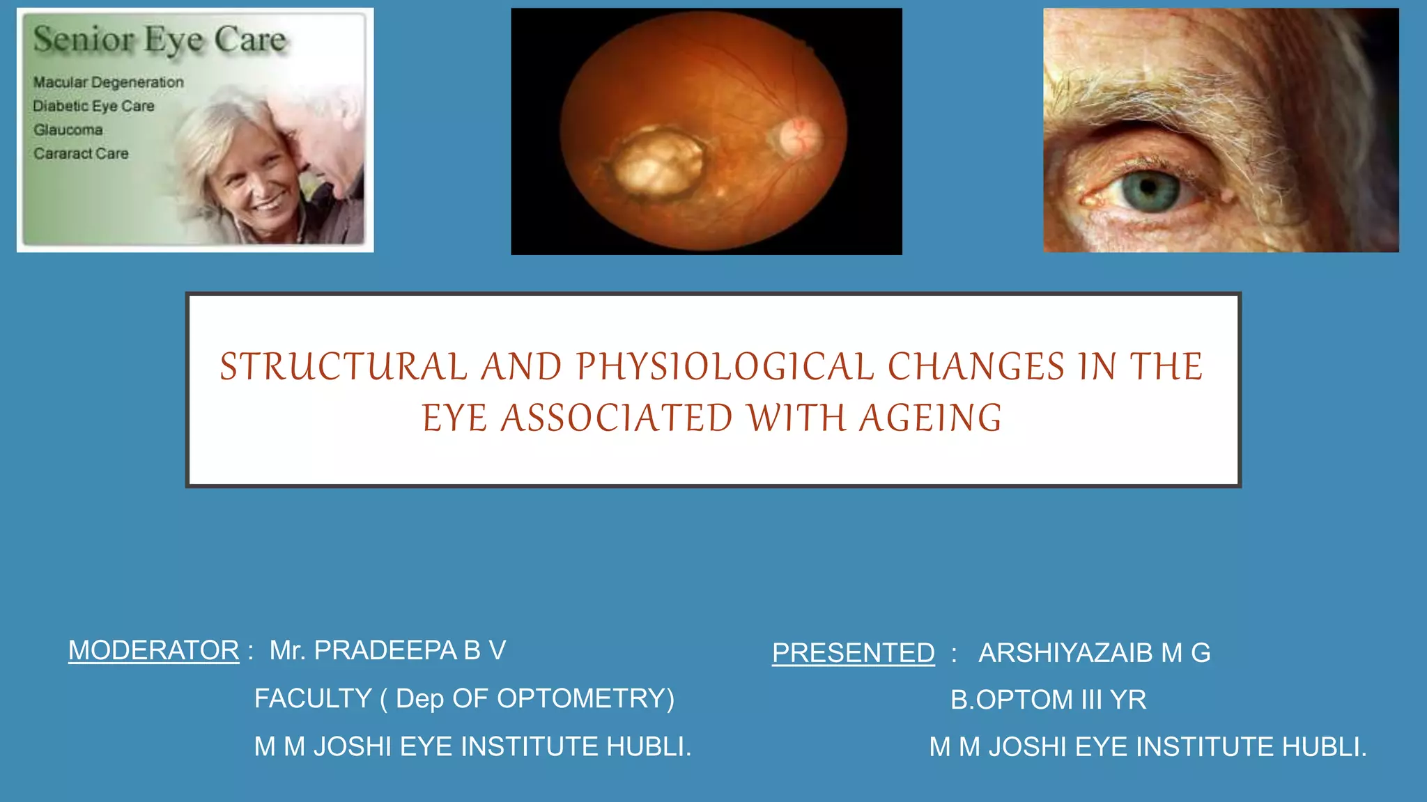 Structural Changes and Physiological Changes in the Eye Associated With ...