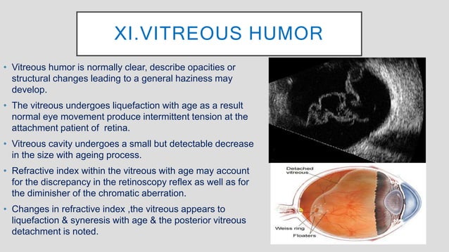 Structural Changes and Physiological Changes in the Eye Associated With ...