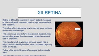 Structural Changes and Physiological Changes in the Eye Associated With ...
