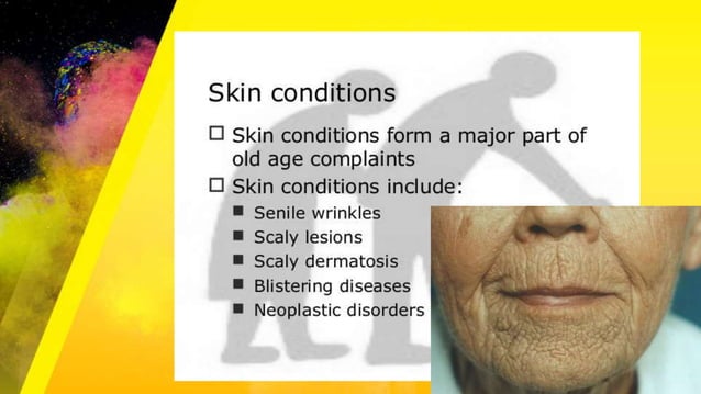 Age Related Problems / Geriatric problems | PPTX