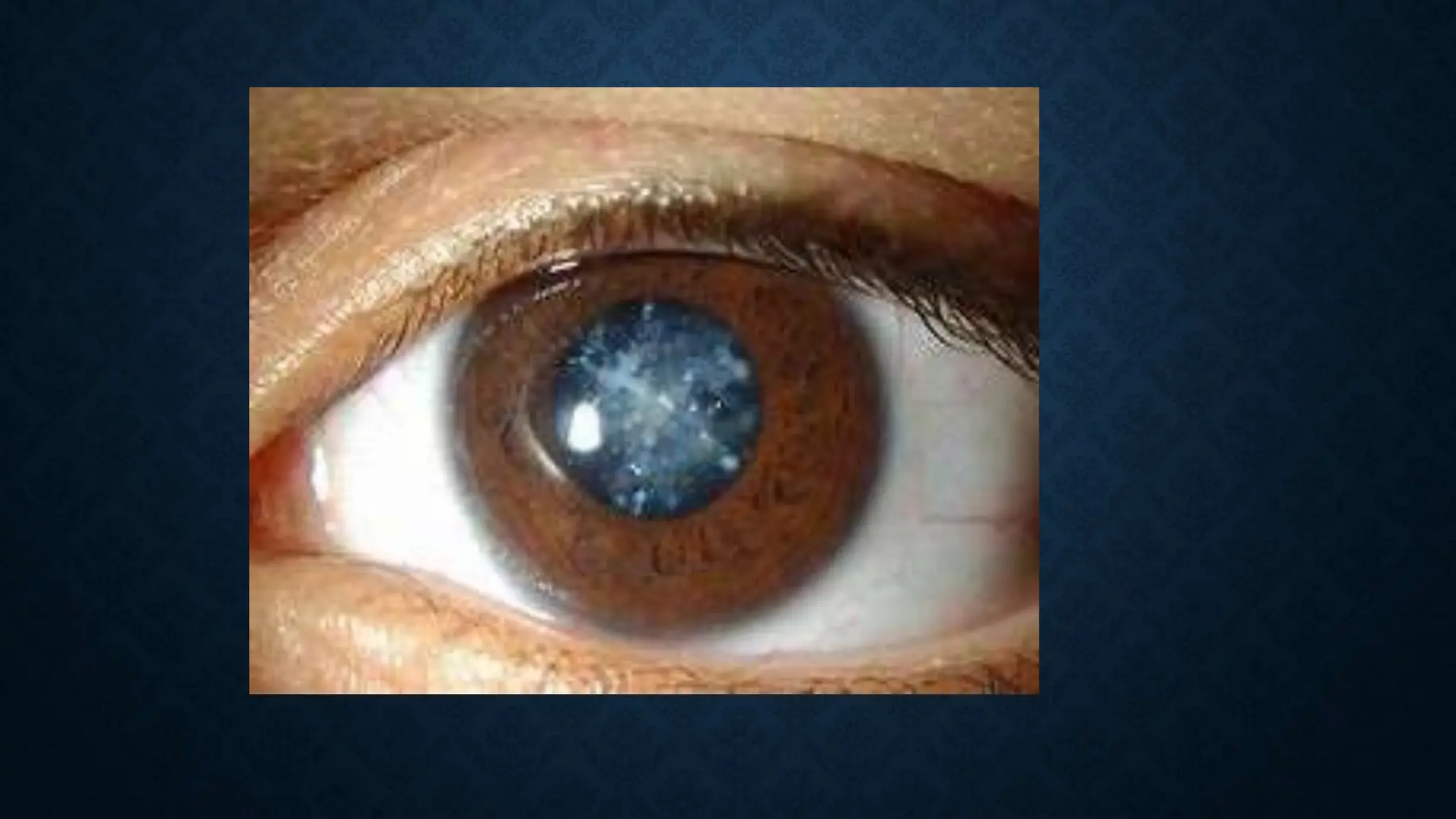 Geriatric radiography.pptx Geriatric radiography.pptxGeriatric ...