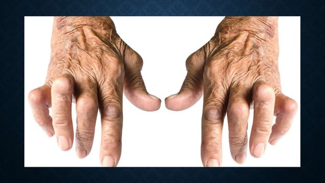 Geriatric radiography.pptx Geriatric radiography.pptxGeriatric ...