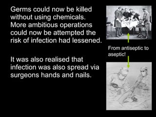 Germ Theory And Surgery | PPT