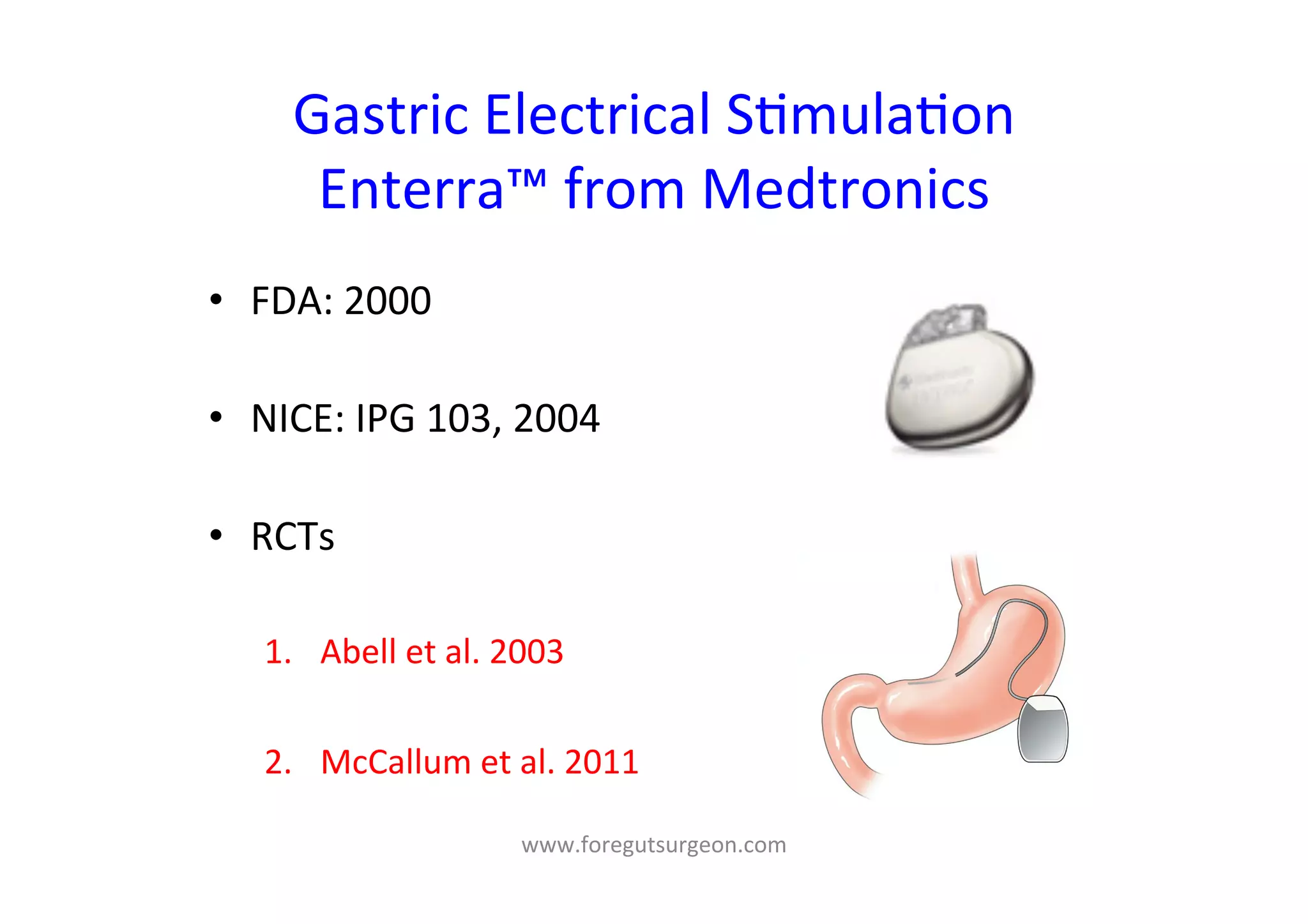 Gastric Electrical Stimulation for Gastroparesis | PDF