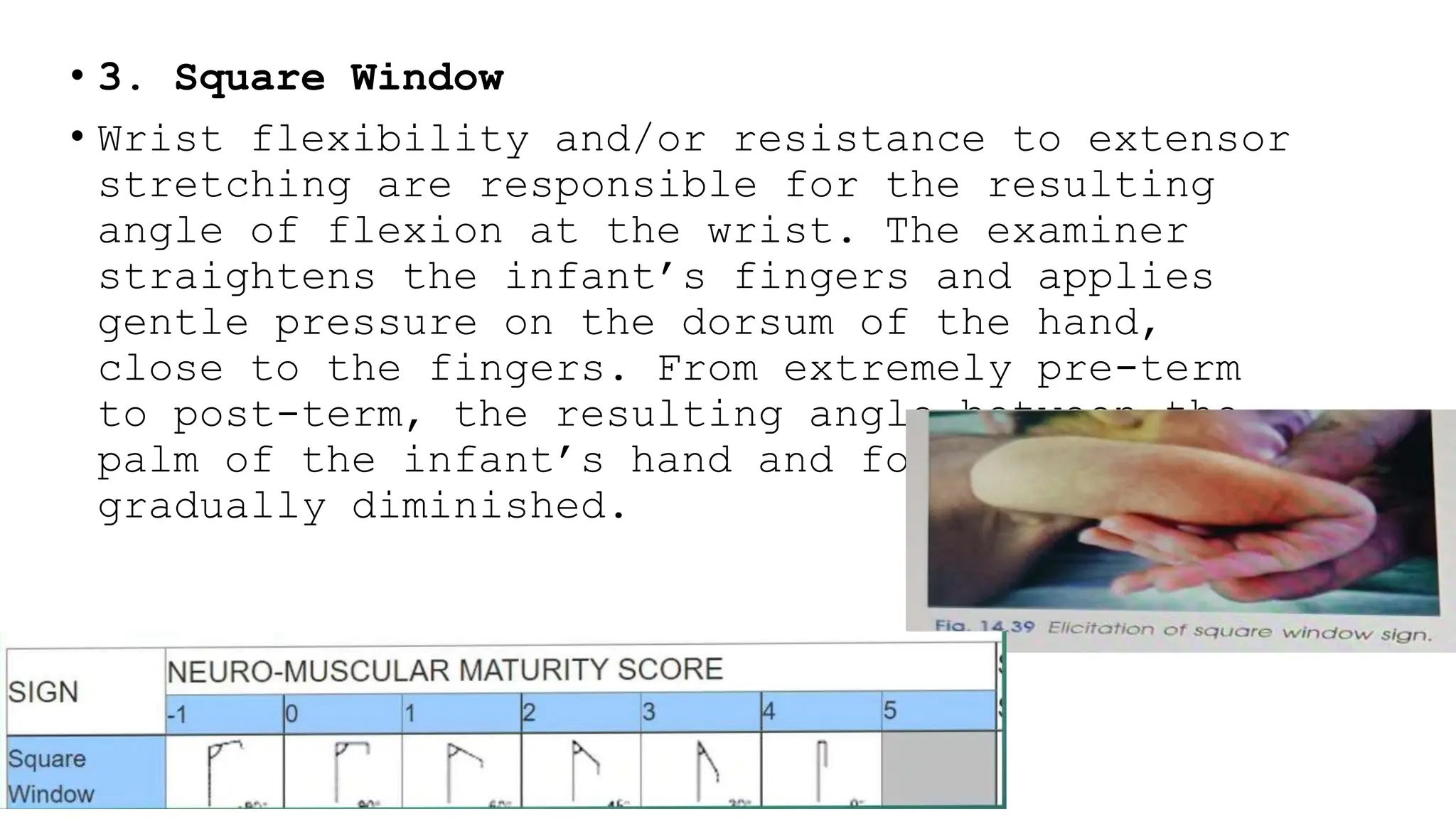 Gestational age estimation- pediatrics.pptx