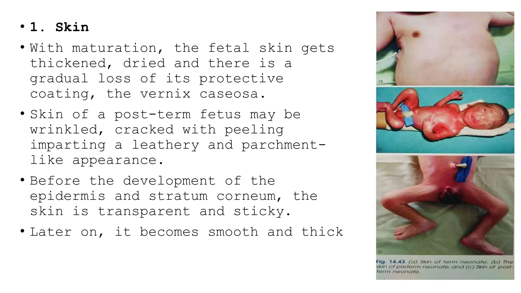 Gestational age estimation- pediatrics.pptx