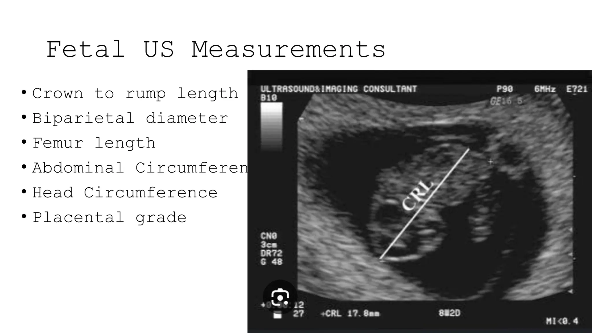 Gestational age estimation- pediatrics.pptx