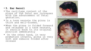 Gestational age estimation- pediatrics.pptx